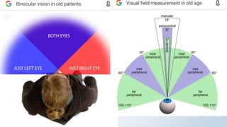 Management of visual problems of Aging by Ashith Tripathi | PPTX