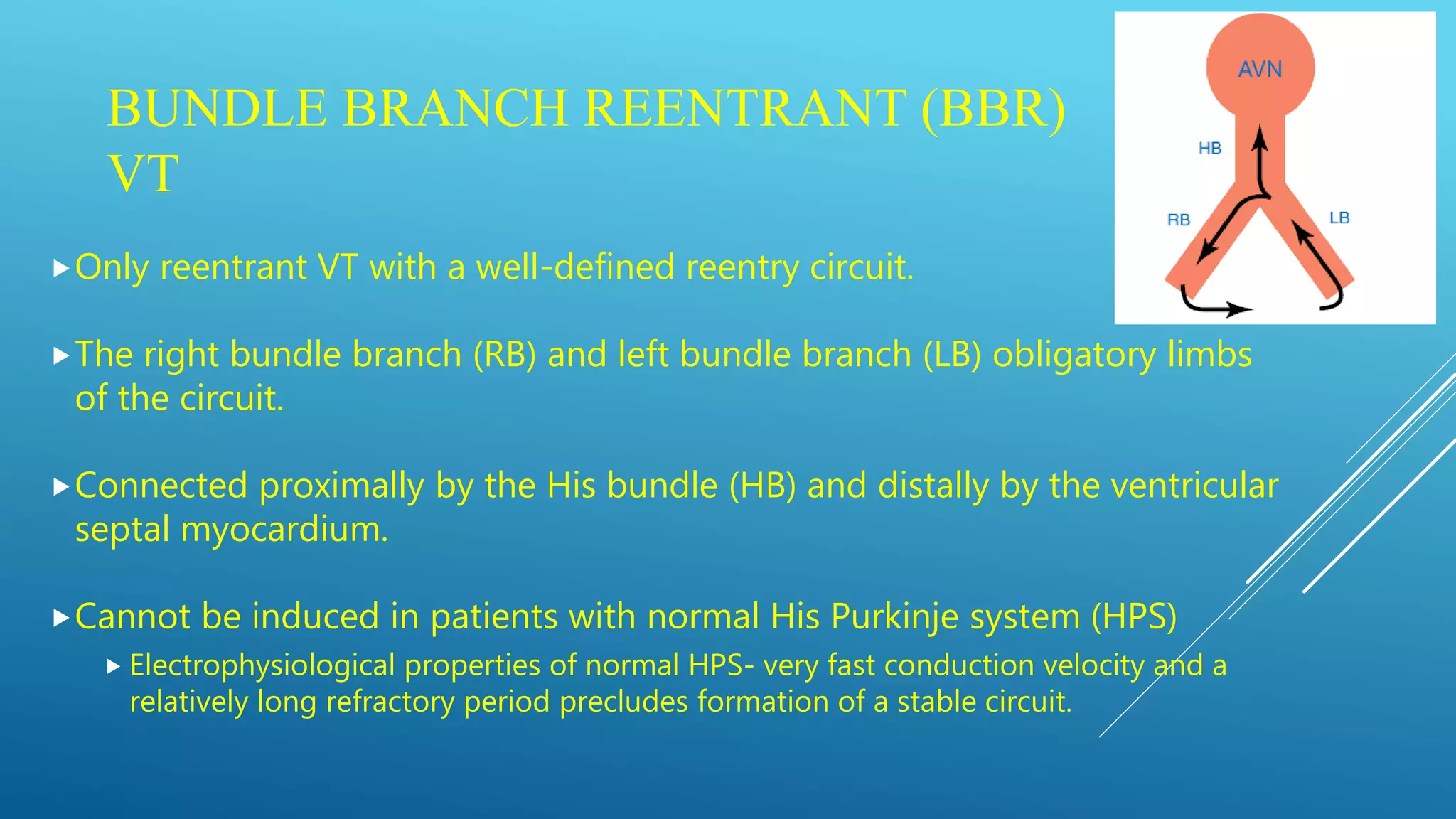 Management of VENTRICULAR TACHYCARDIA (VT) | PPTX