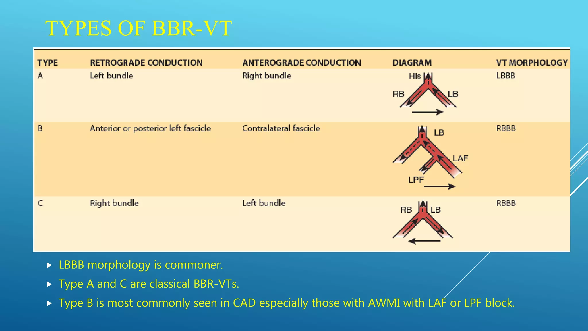 Management of VENTRICULAR TACHYCARDIA (VT) | PPTX