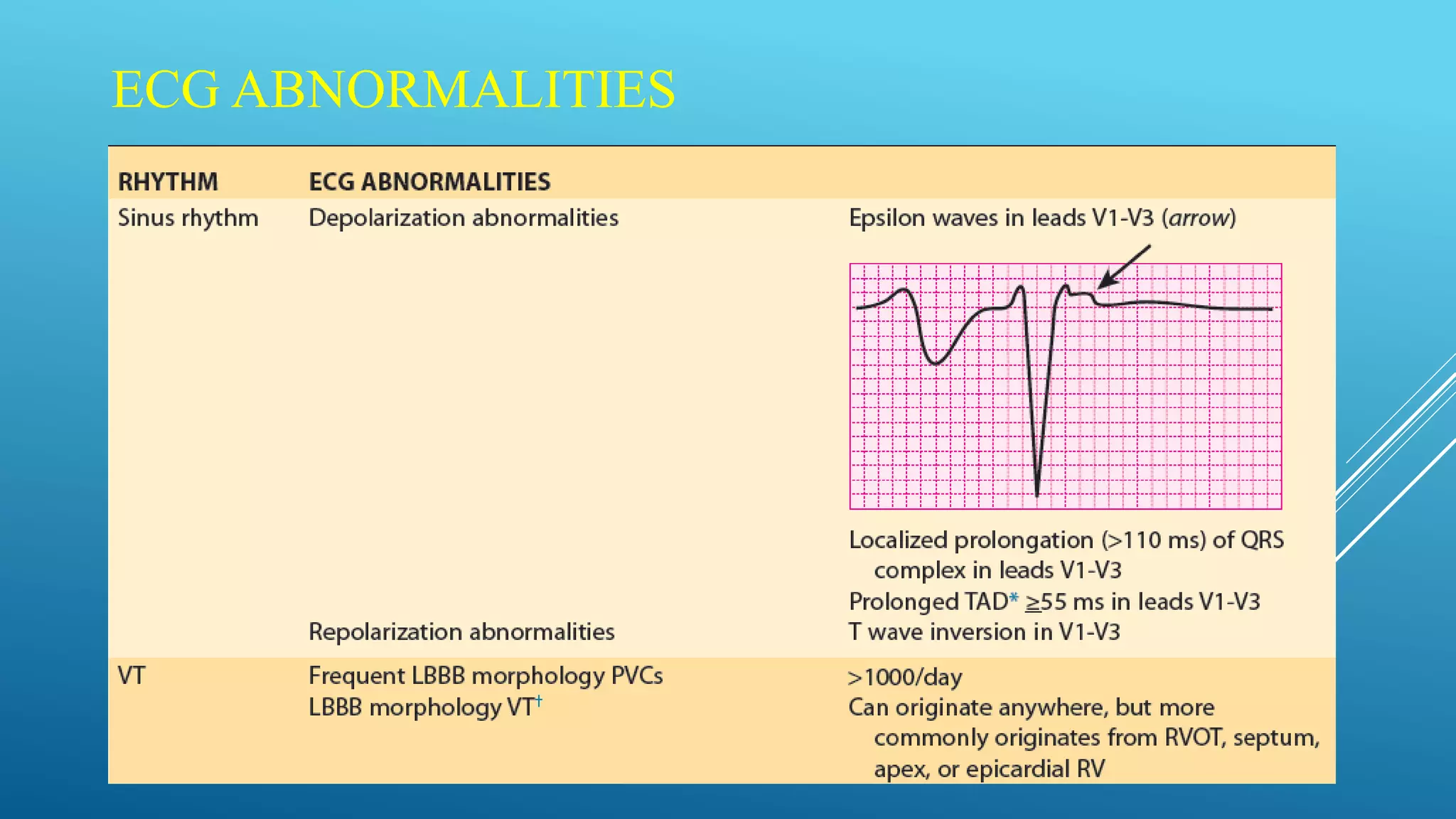 Management of VENTRICULAR TACHYCARDIA (VT) | PPTX