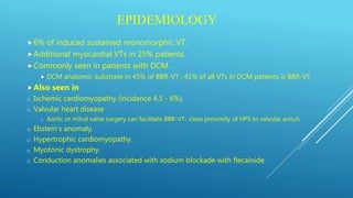 Management of VENTRICULAR TACHYCARDIA (VT) | PPTX