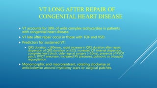 Management of VENTRICULAR TACHYCARDIA (VT) | PPTX