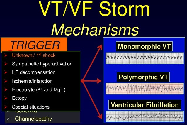 Management of vt vf storm in advanced heart failure