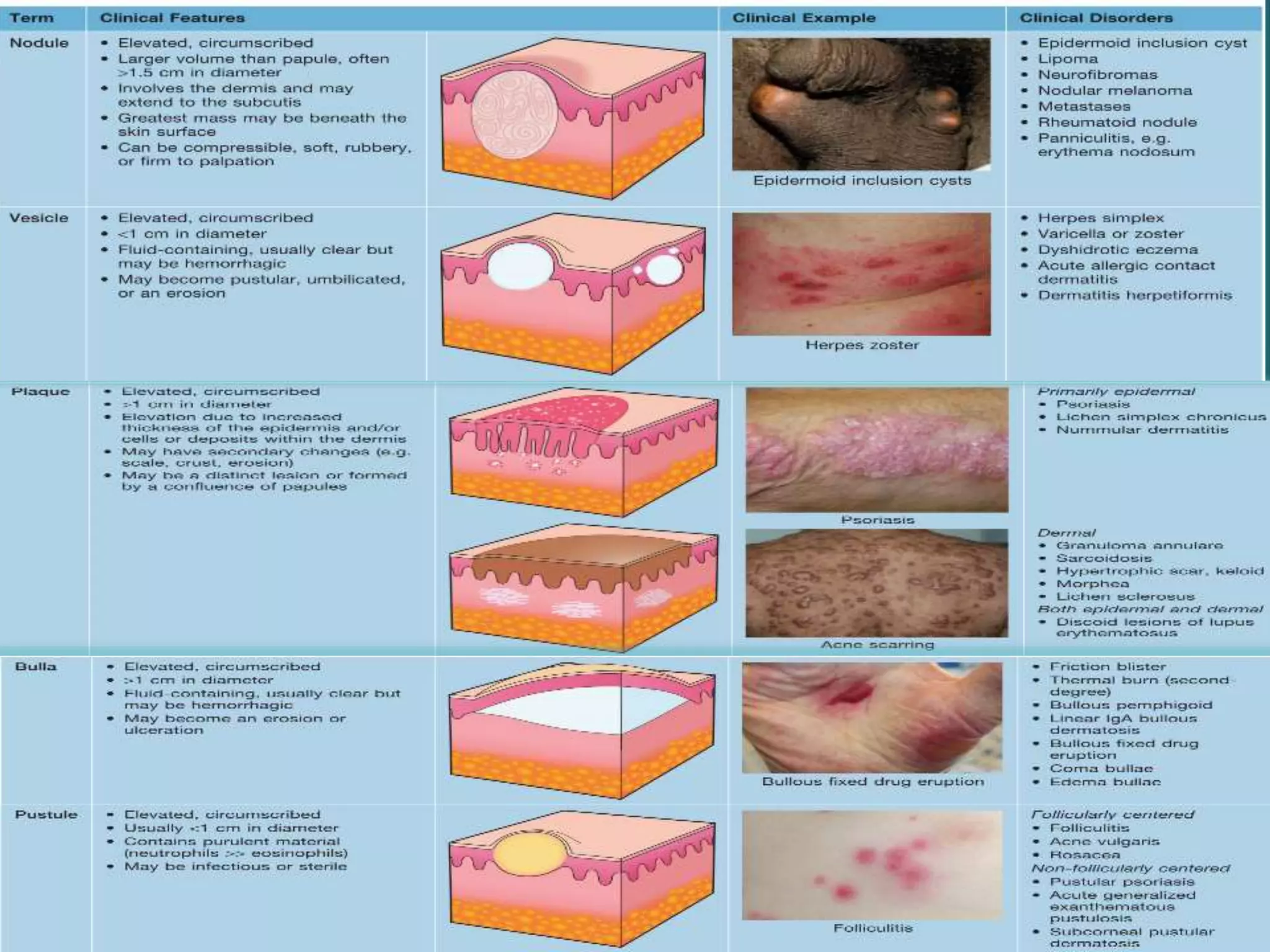 Management of vulval itching caused by benign vulval22 | PPTX