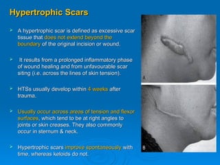management of acute and chronic wounds.ppt