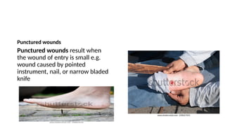 Wounds and Principles of Wound Management | PPTX
