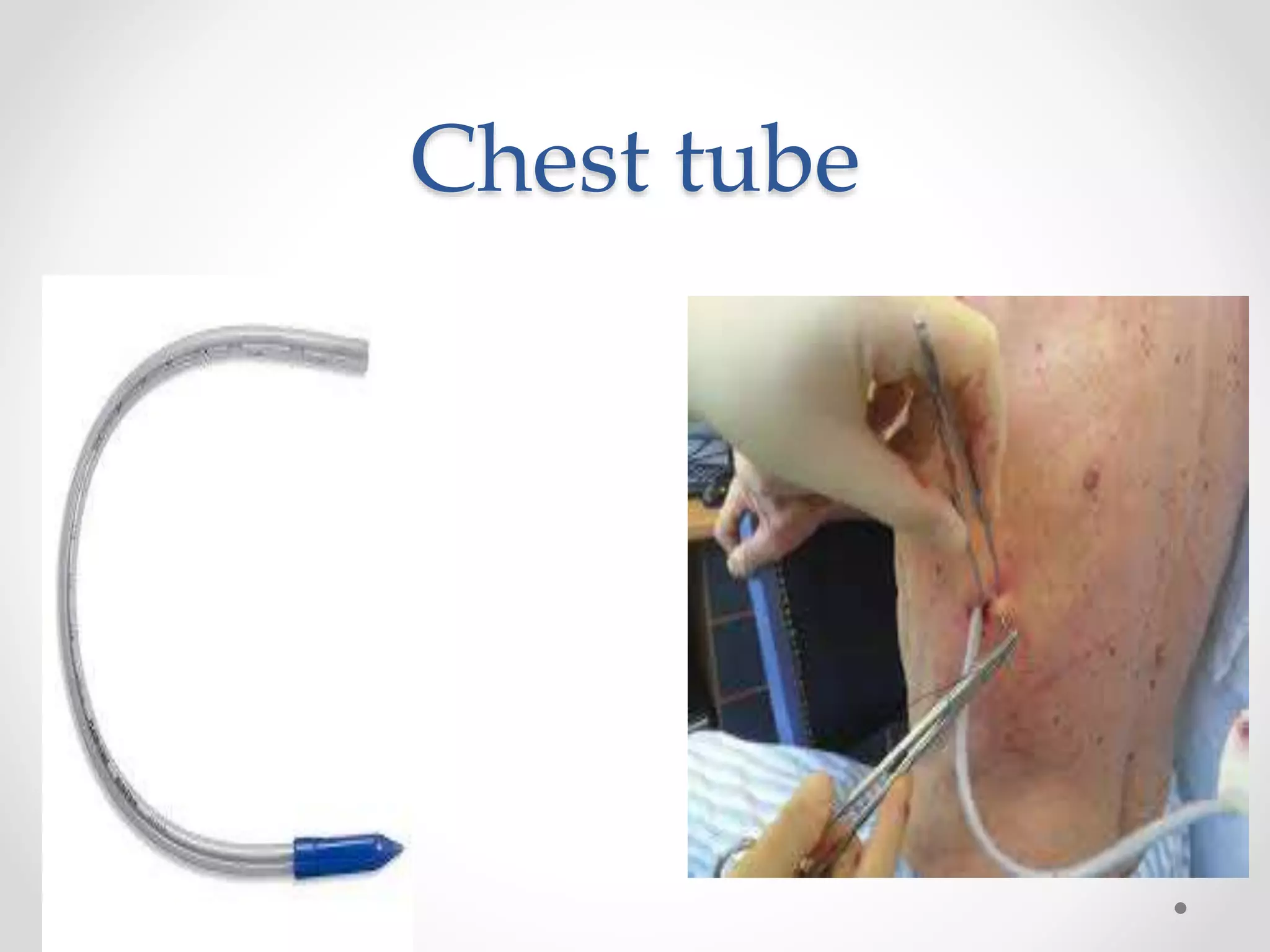 Management of wounds and drains | PPTX