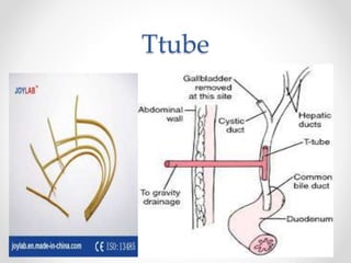 Management of wounds and drains | PPTX
