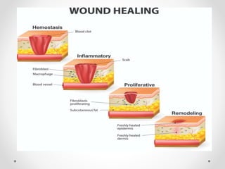 Management of wounds and drains | PPTX