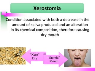 Management of xerostomic patient in prosthodontics | PPTX