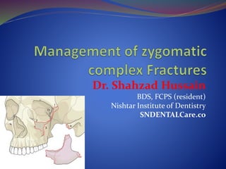 Zygomatic Fracture Treatment
