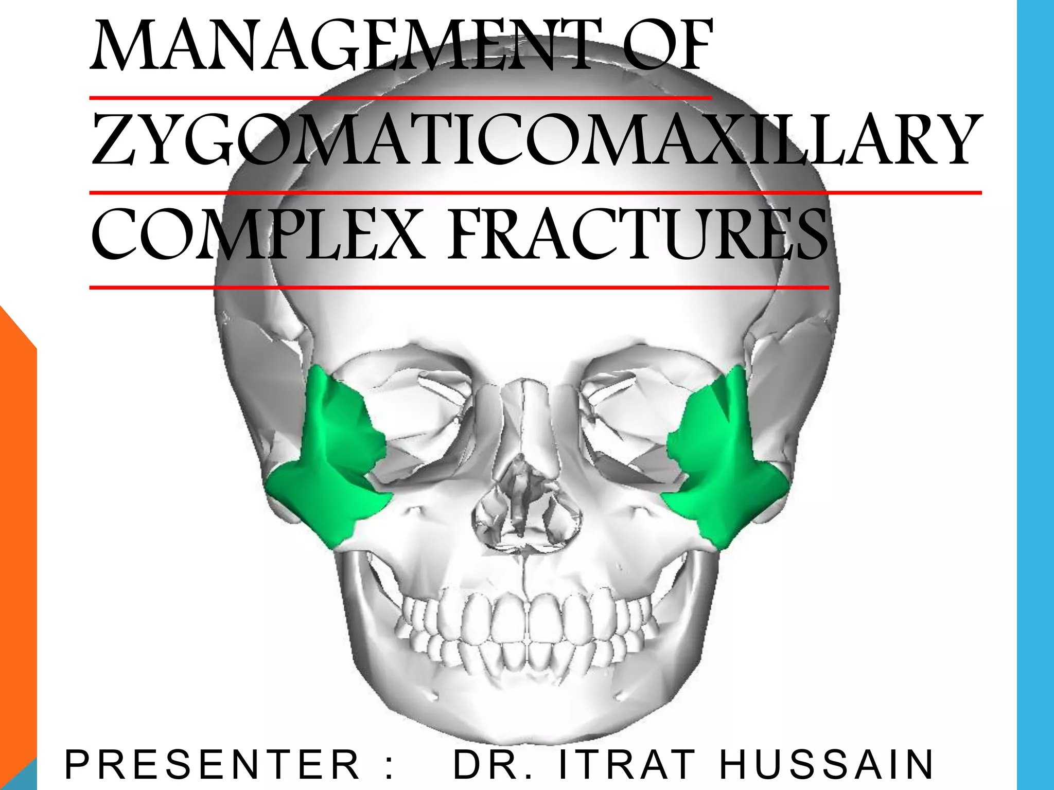Management of zygomaticomaxillary complex fractures ih | PPTX
