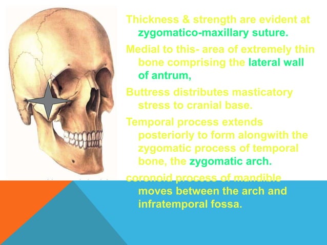 Management of zygomaticomaxillary complex fractures ih | PPTX