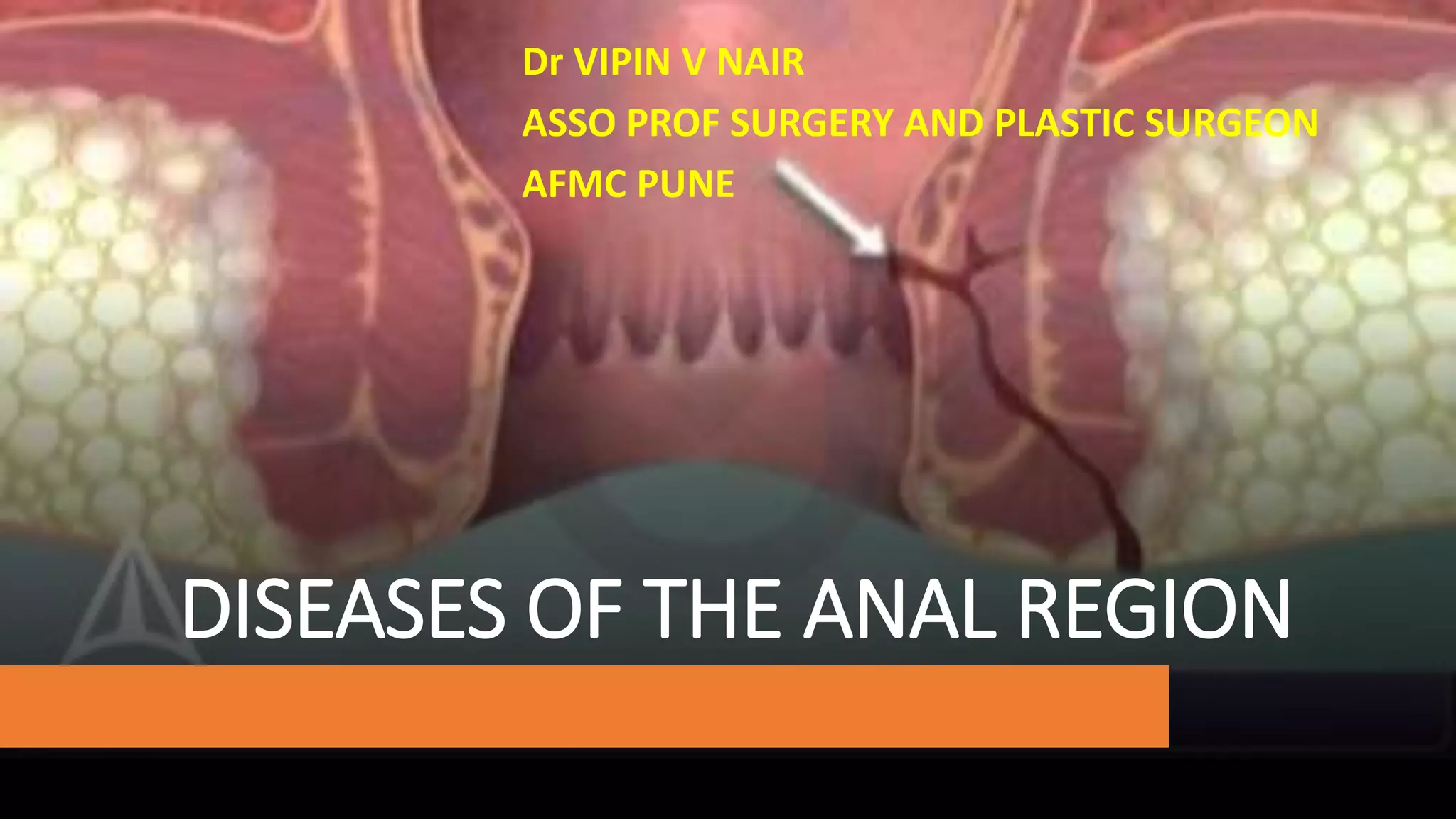 ANO RECTAL DISEASES- MANAGEMENT OPTIONS | PPTX | Physical Therapy ...