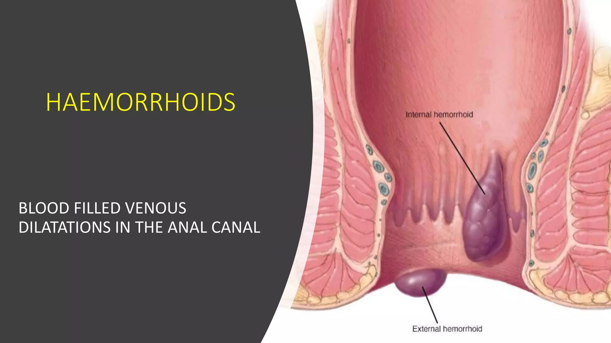 ANO RECTAL DISEASES- MANAGEMENT OPTIONS | PPTX | Physical Therapy | Wellness