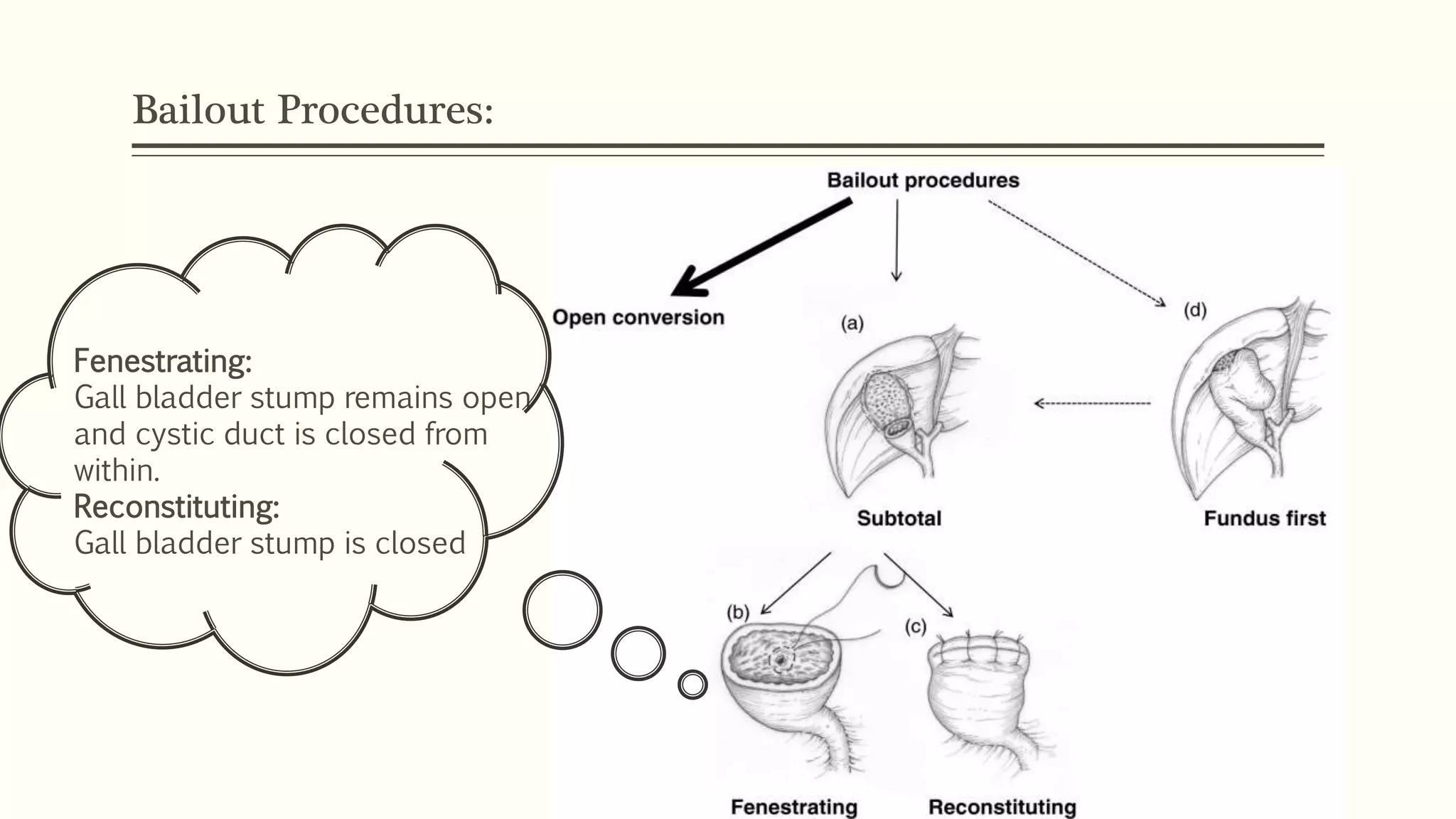 Management plan of acute cholecystitis | PPTX