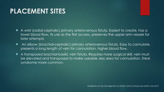 Management Pre Operative of Arterio Venous Fistula.pptx