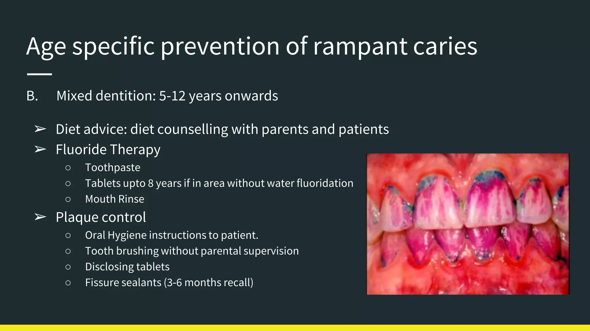 Management & Prevention of early childhood caries | PPTX