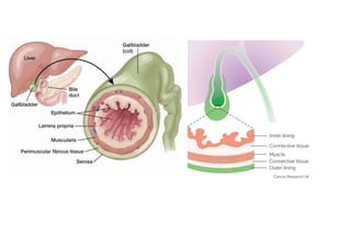 Management strategy in cancer gall bladder | PPT