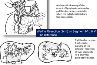 Management strategy in cancer gall bladder | PPT
