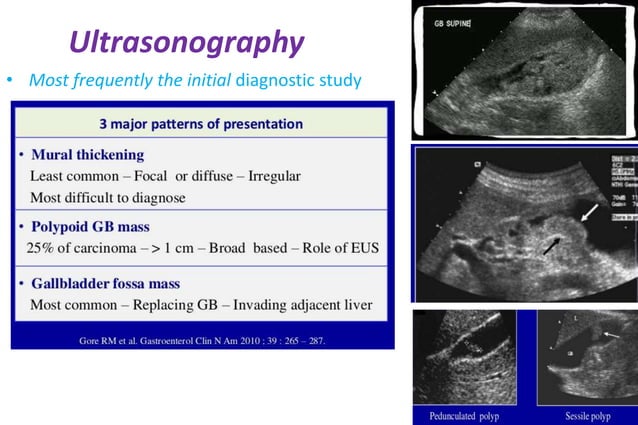 Management strategy in cancer gall bladder | PPT