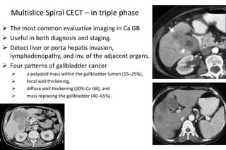 Management strategy in cancer gall bladder | PPT
