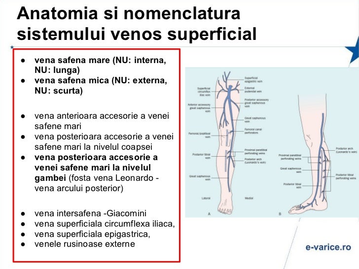 Managementul pacientilor cu varice