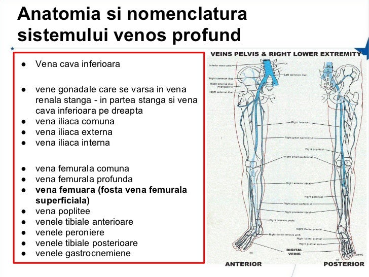 Managementul pacientilor cu varice