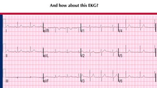 Understand the Management of Unstable Angina (UA) | PDF