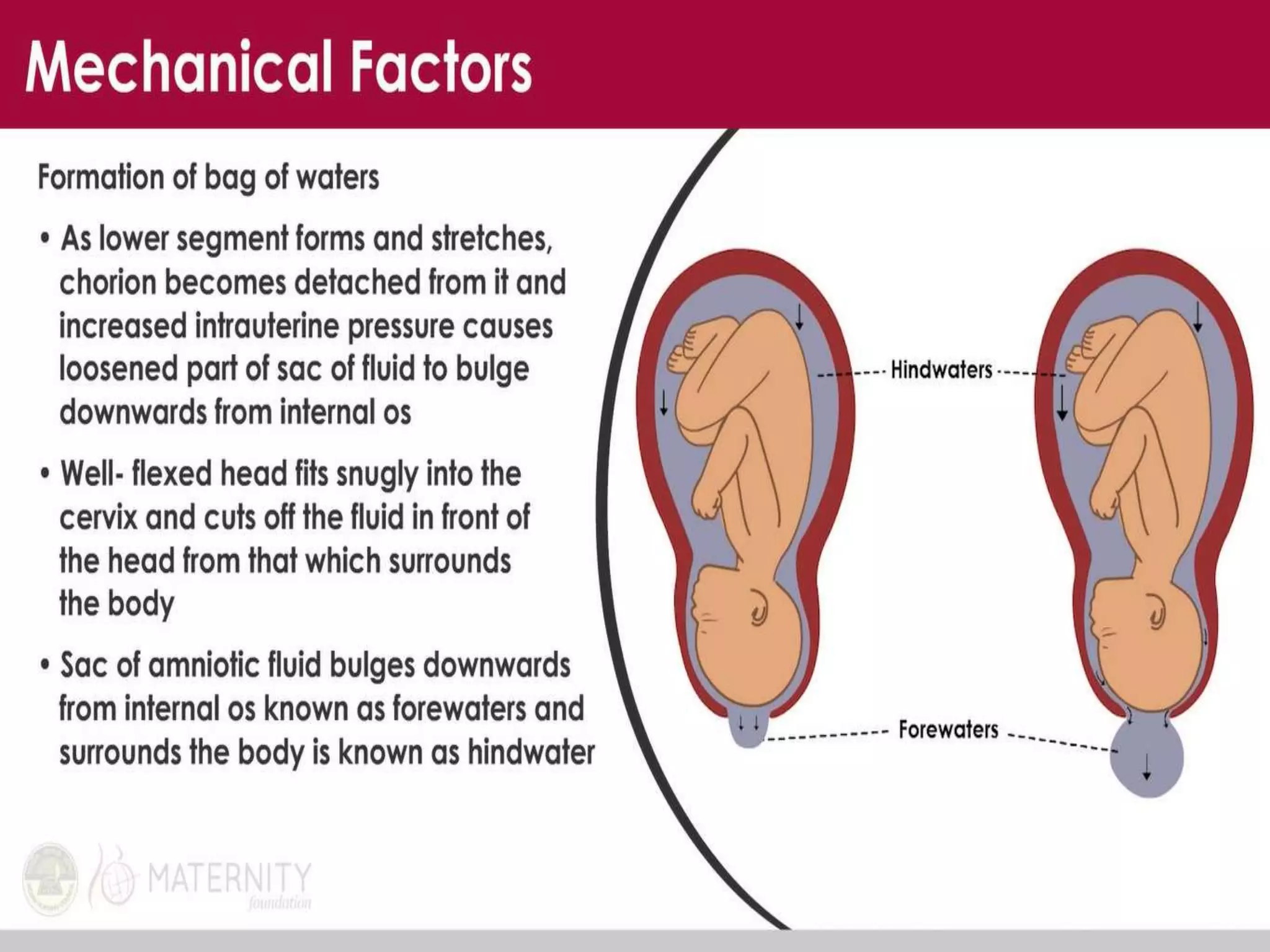 MANAGEMNET OF STAGES OF LABOUR and amtsl.pptx