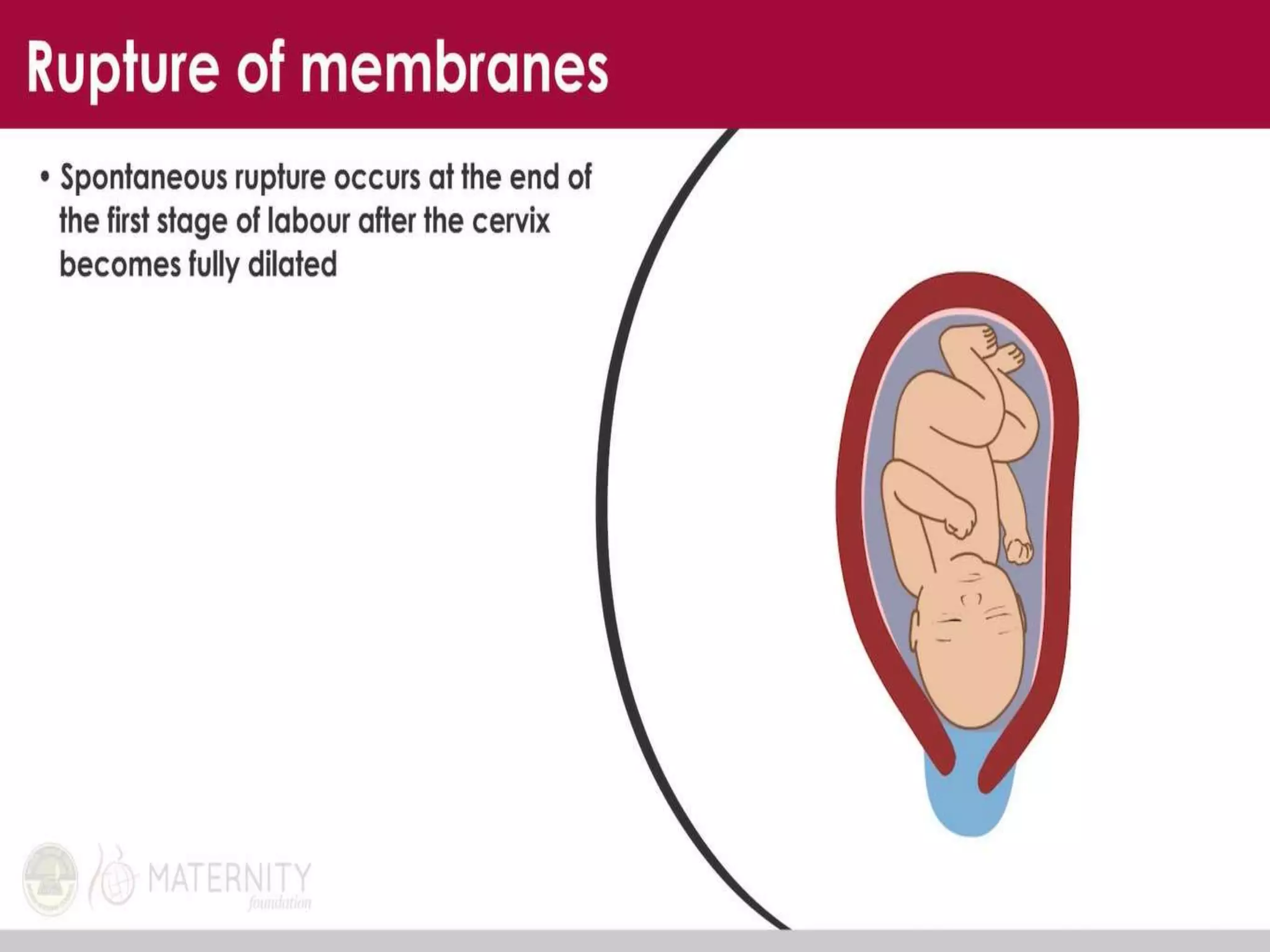 MANAGEMNET OF STAGES OF LABOUR and amtsl.pptx