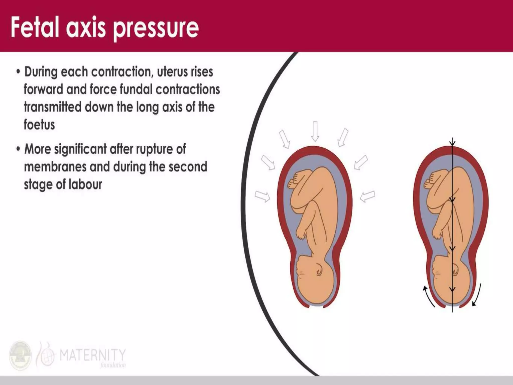 MANAGEMNET OF STAGES OF LABOUR and amtsl.pptx