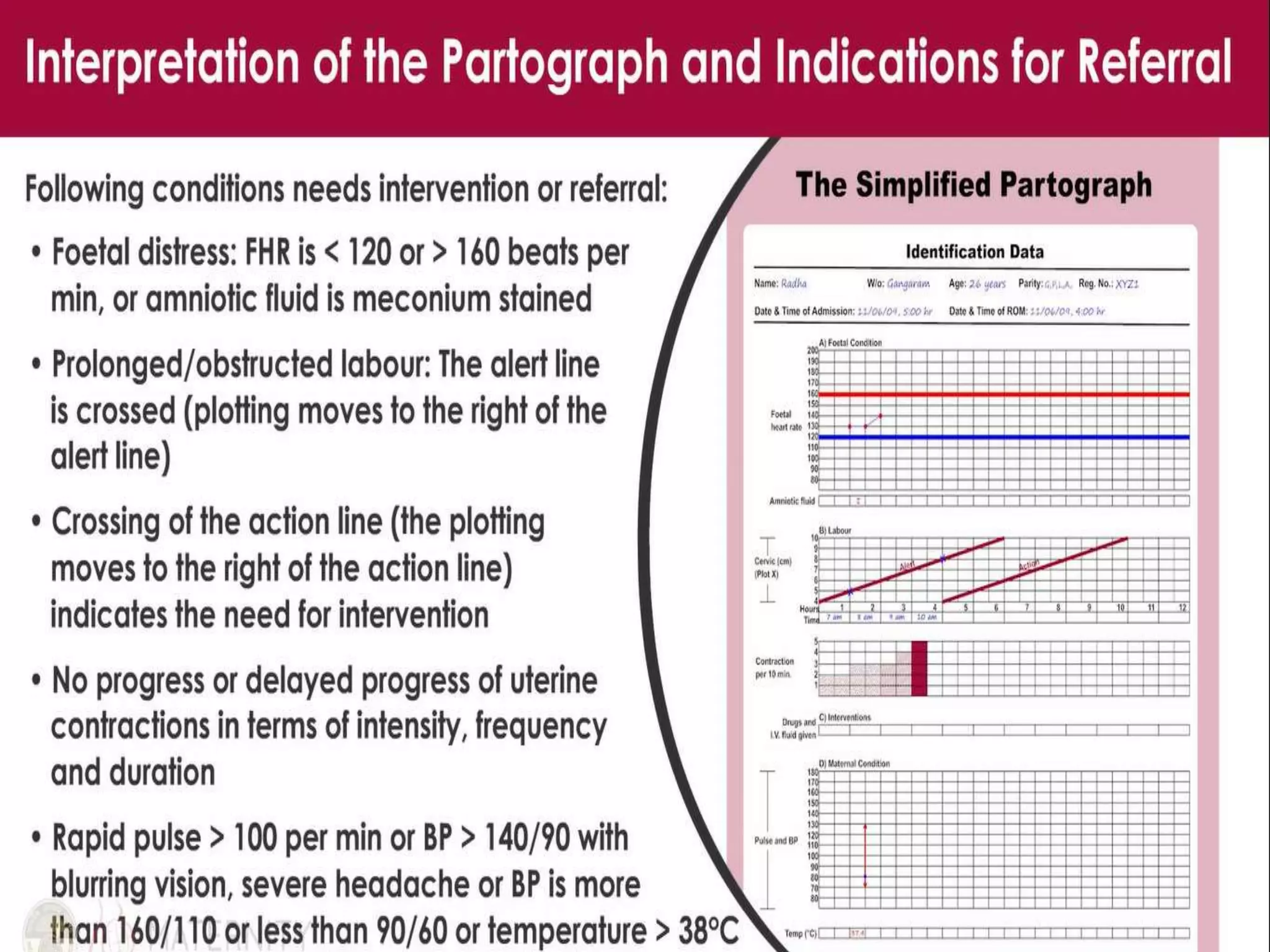 MANAGEMNET OF STAGES OF LABOUR and amtsl.pptx