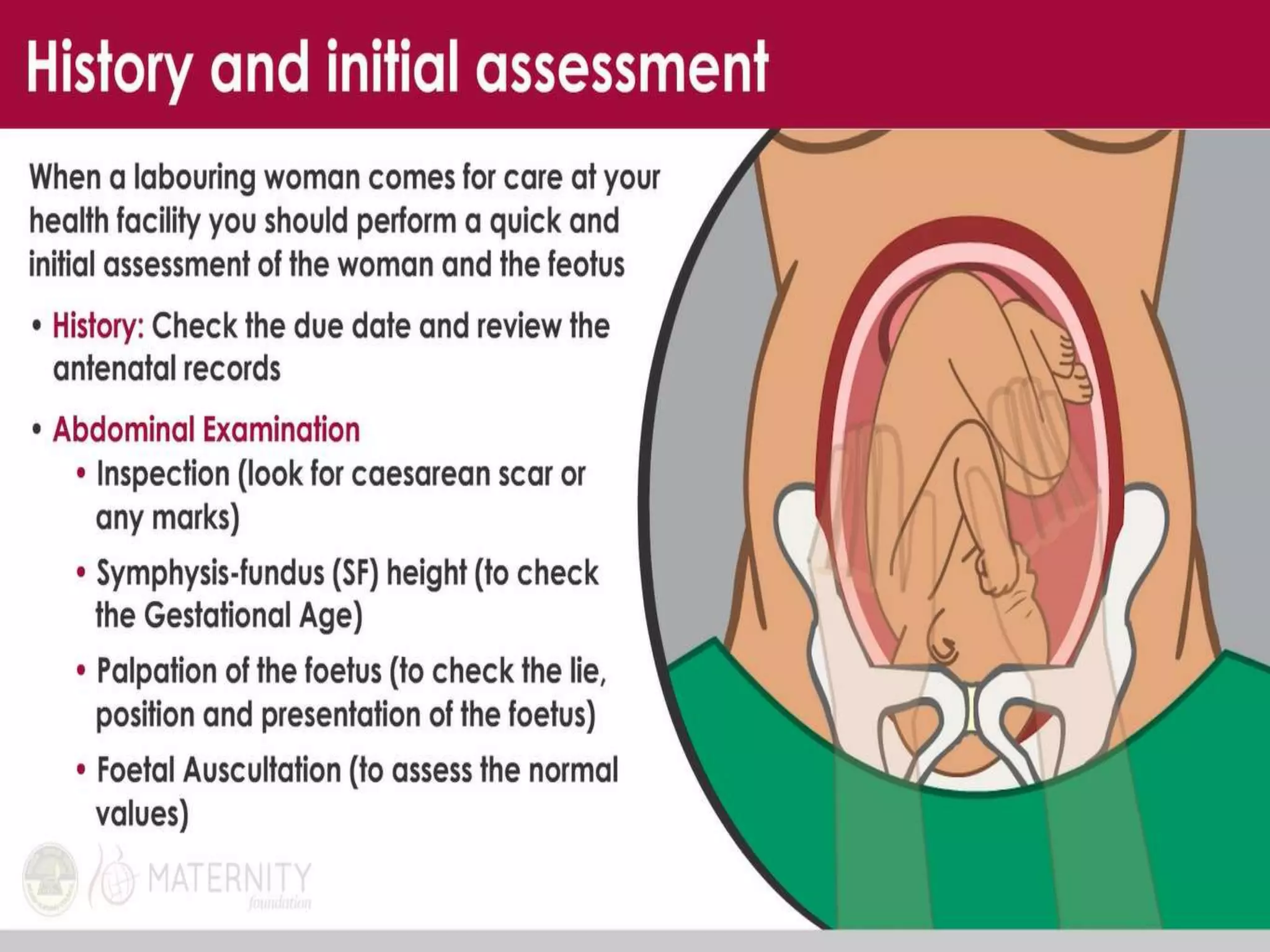 MANAGEMNET OF STAGES OF LABOUR and amtsl.pptx