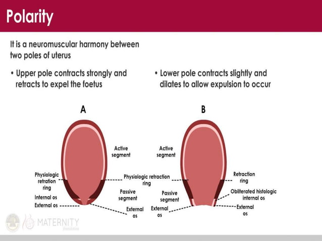 MANAGEMNET OF STAGES OF LABOUR and amtsl.pptx