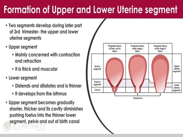 MANAGEMNET OF STAGES OF LABOUR and amtsl.pptx