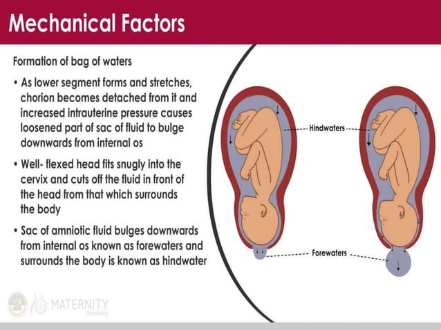 MANAGEMNET OF STAGES OF LABOUR and amtsl.pptx