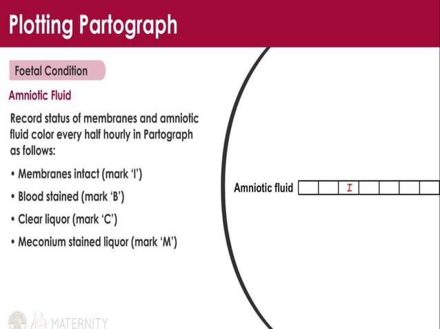 MANAGEMNET OF STAGES OF LABOUR and amtsl.pptx