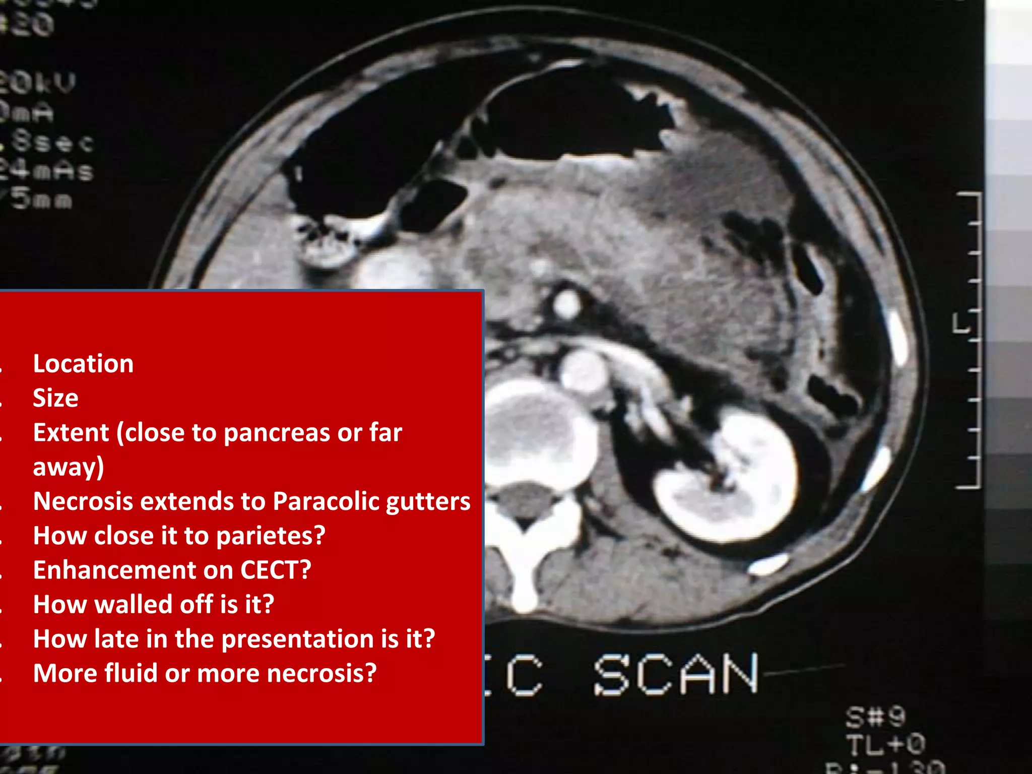 Managemnt of pancreatic necrosis and fluid collection | PPTX