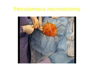 Managemnt of pancreatic necrosis and fluid collection | PPTX