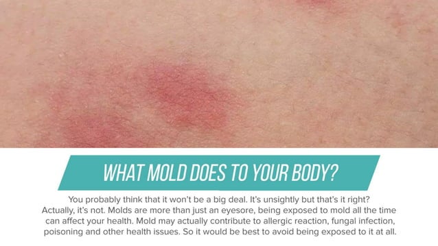 Manage Mold Build Up In Your Bathroom