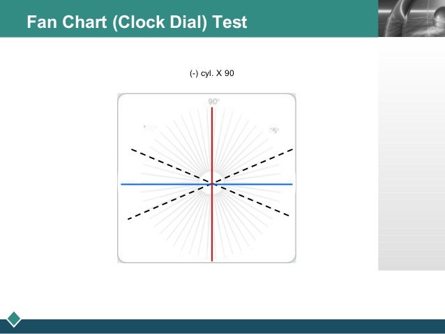 Managing astigmatic patients