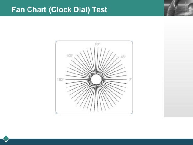 Managing astigmatic patients
