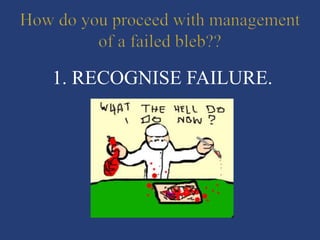 Managing bleb failure - A brief guide | PPTX