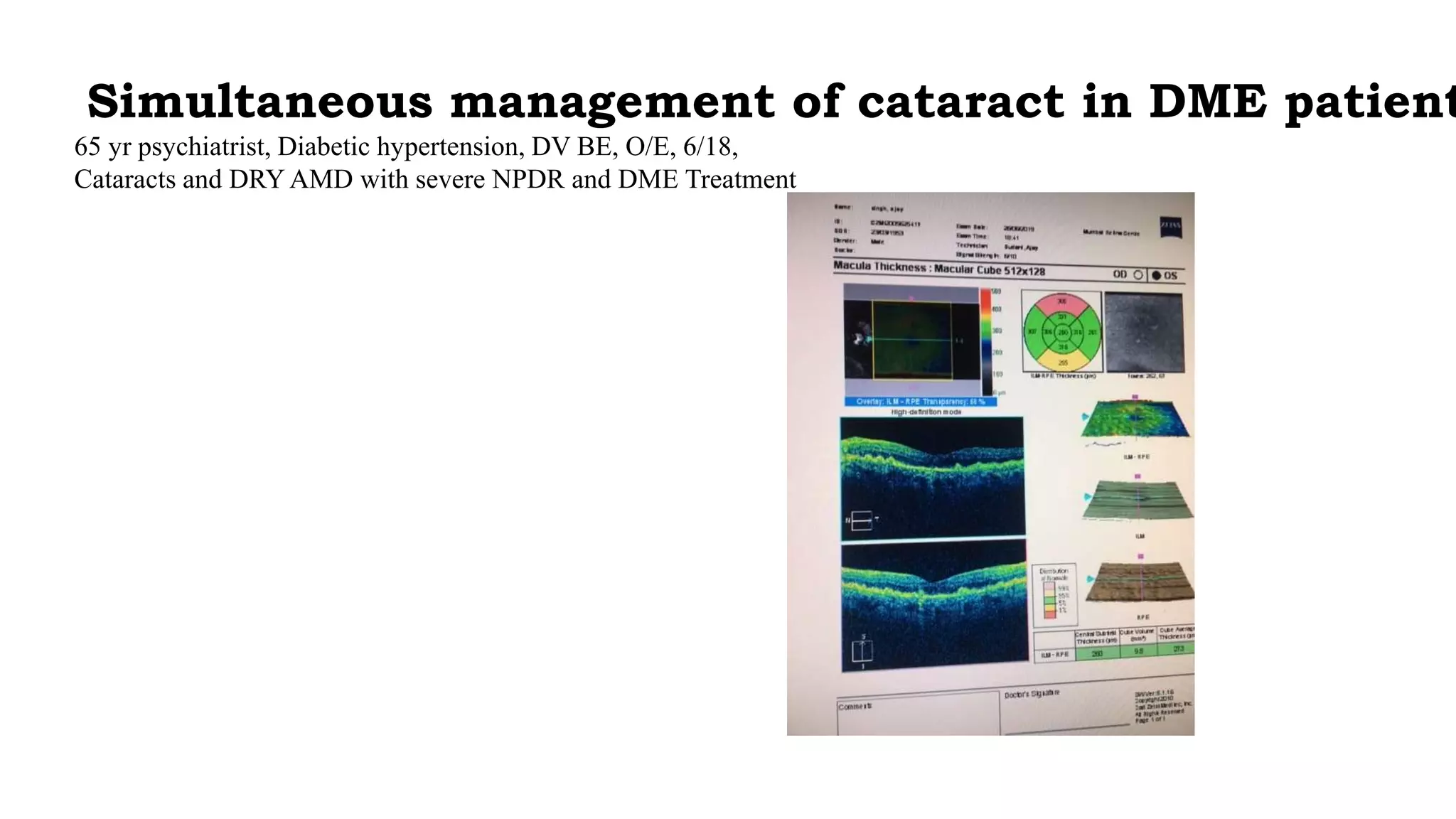 Managing cataract in DME patients simULTANEOUS injection and ...