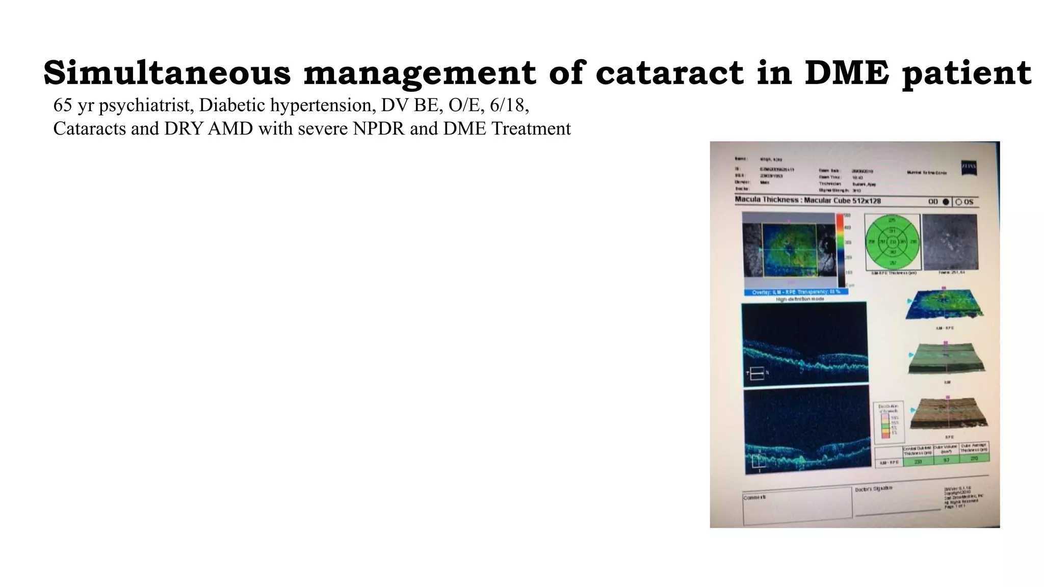 Managing cataract in DME patients simULTANEOUS injection and ...