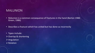 Managing complications | PPT