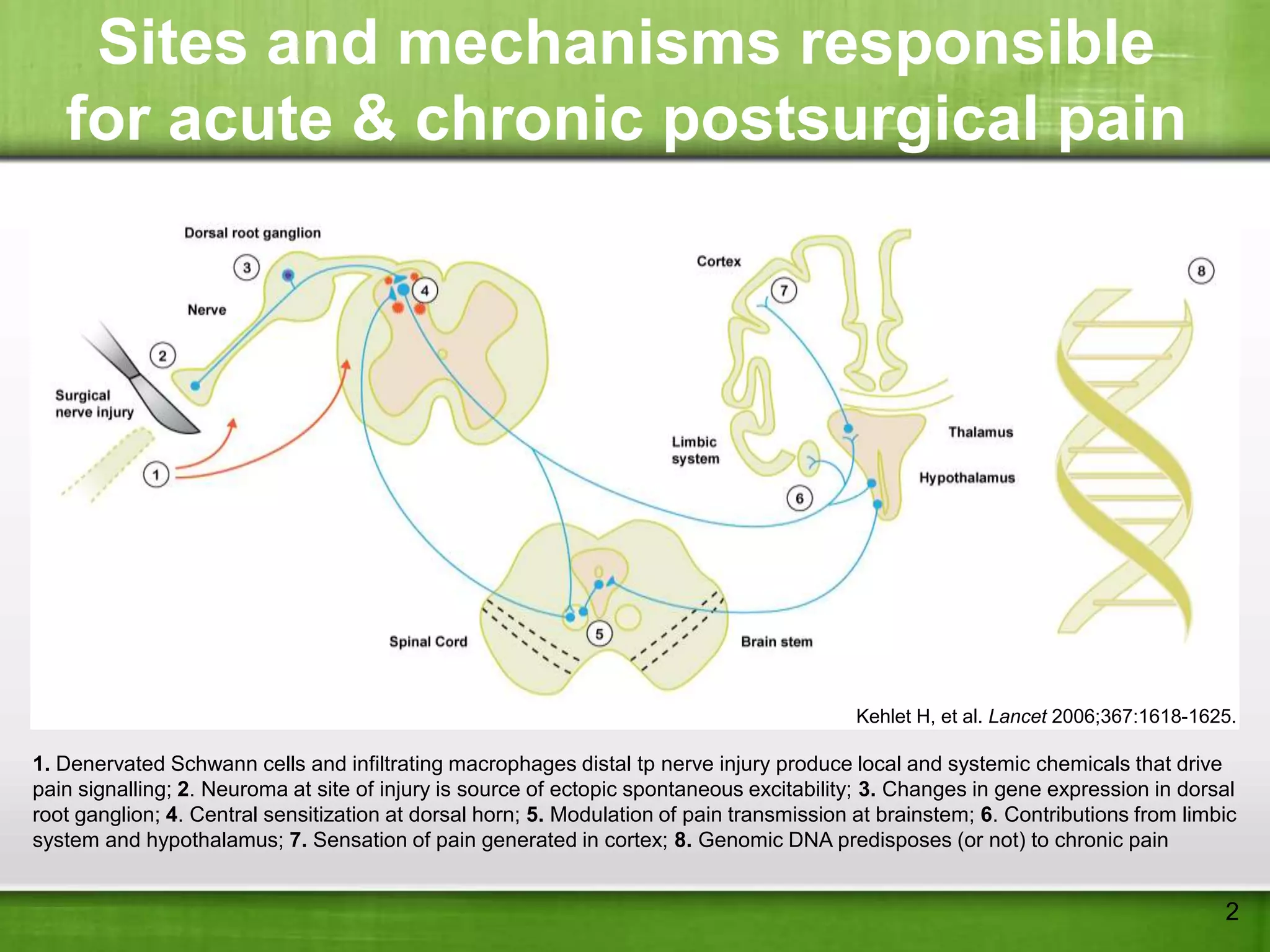 Managing pain after surgery short | PPT