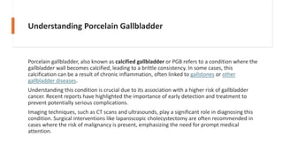 Managing Porcelain - Gallbladder Patient Guide.pdf
