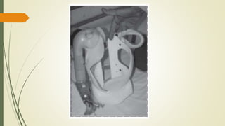 Managing shoulder amputation | PPT